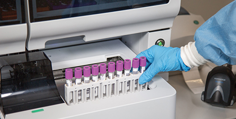 PS-10™ Sample Preparation System | Sysmex America